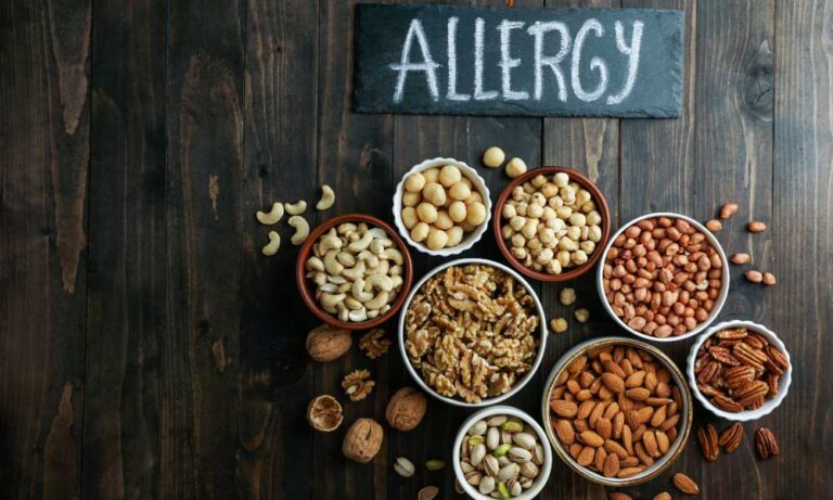 Olive Oil & Garlic Walnuts - Allergy Associates of La Crosse